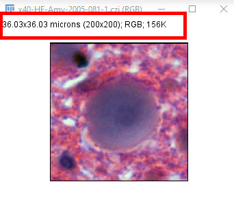 【ImageJ/Fiji】イメージサイズ（解像度）を変更