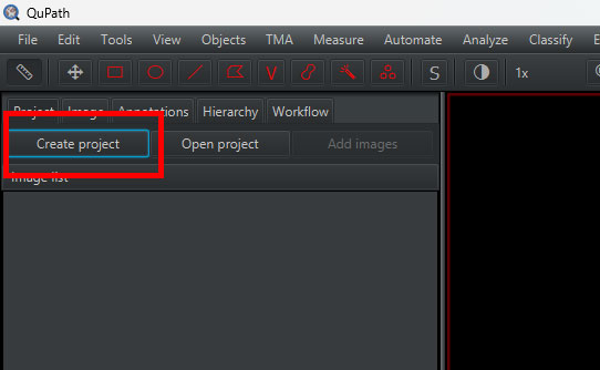 【QuPath】スキャナ画像を取り込んで観察する